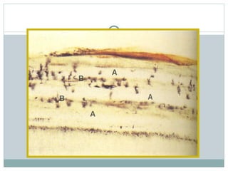 CEMENTUM AND CEMENTOGENESIS LECTURE.pptx