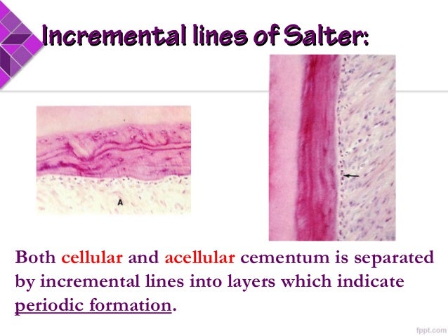 Cementum