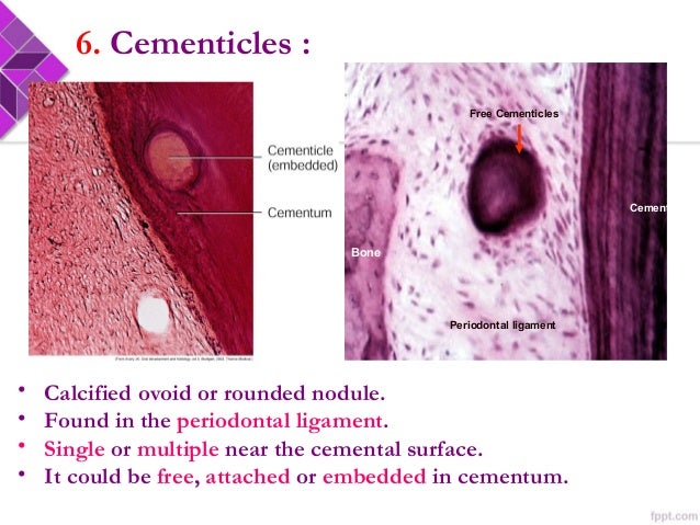Cementum