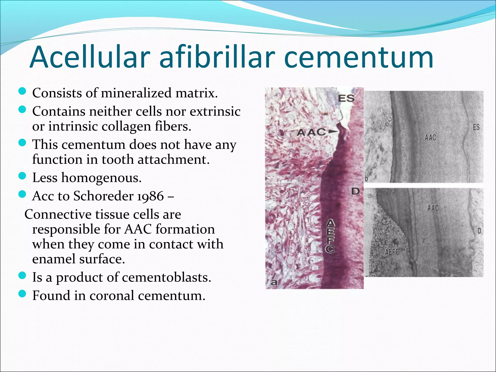 Cementum | PPT