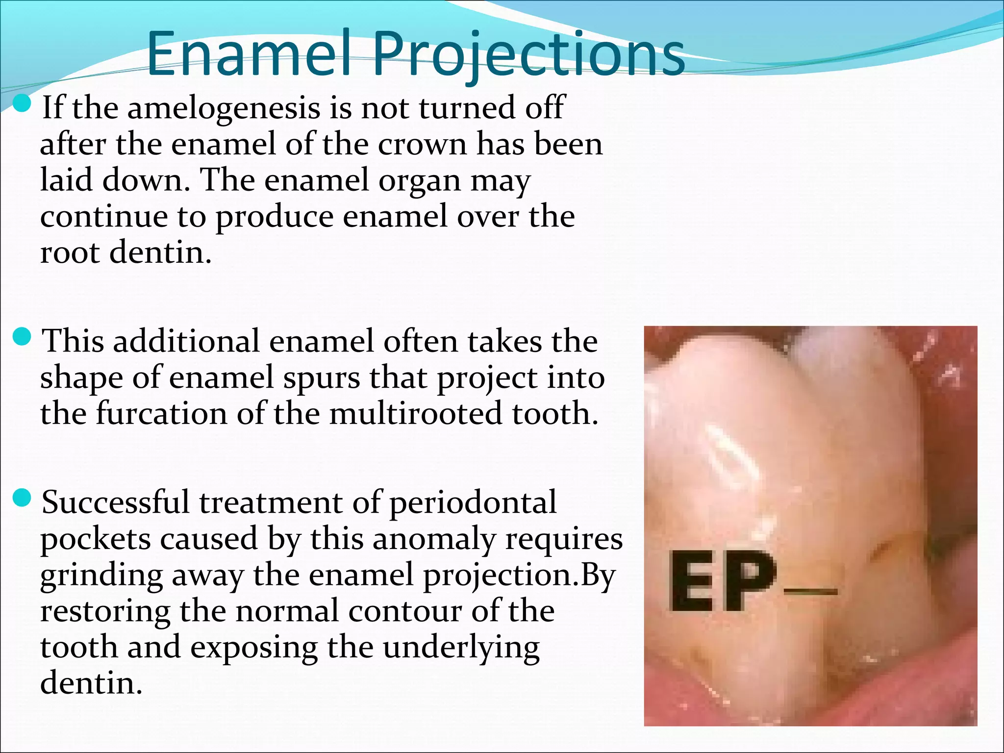 Cementum | PPT