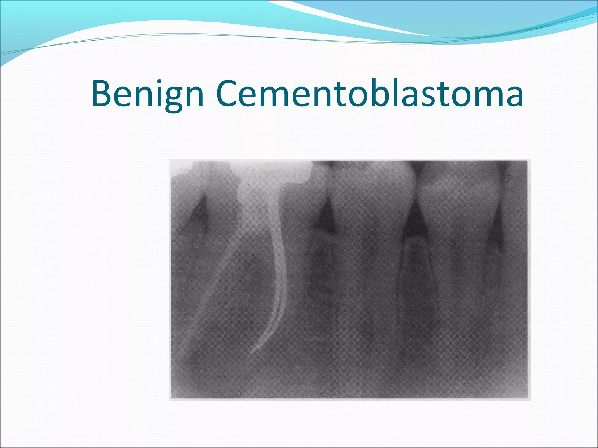 Cementum | PPT