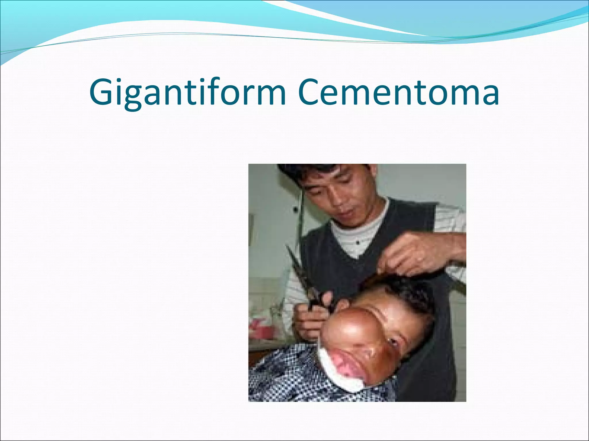 Cementum | PPT