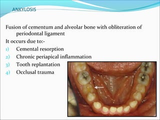 Cementum | PPT