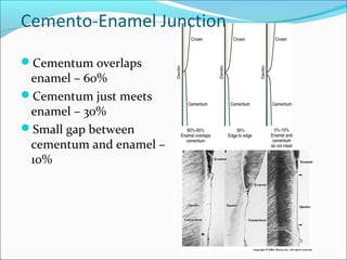 Cementoenamel Junction