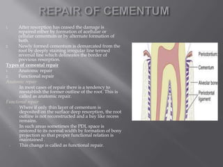Cementum ppt | PPTX