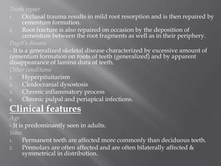 Cementum ppt | PPTX