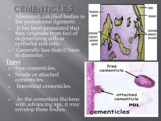 Cementum ppt | PPTX