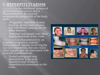 Cementum ppt | PPTX