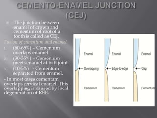 Cementoenamel Junction