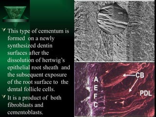 cementum in periodontics and classification of cementum, composition of ...