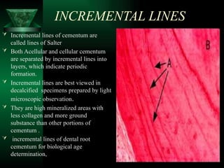 cementum in periodontics and classification of cementum, composition of ...