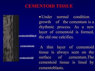 Cementum /certified fixed orthodontic courses by Indian dental academy ...