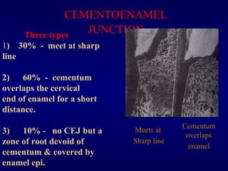 Cementum /certified fixed orthodontic courses by Indian dental academy ...