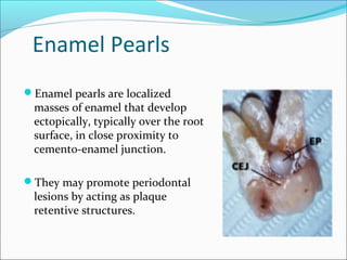 Cementum seminar | PPT