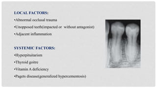 Cementum in Dentistry | PPTX