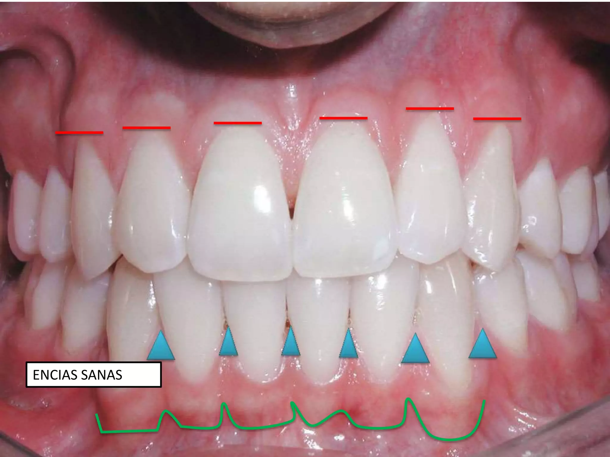 Cenit | PPTX | Oral care | Personal Care