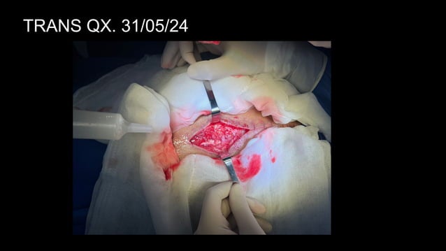 CENSO IMAGENES TYO 02_06_2024 actualizado.pdf