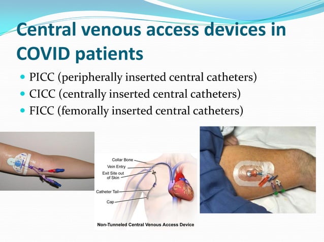Central-Venous-Catheterization.pdf presentation | PDF