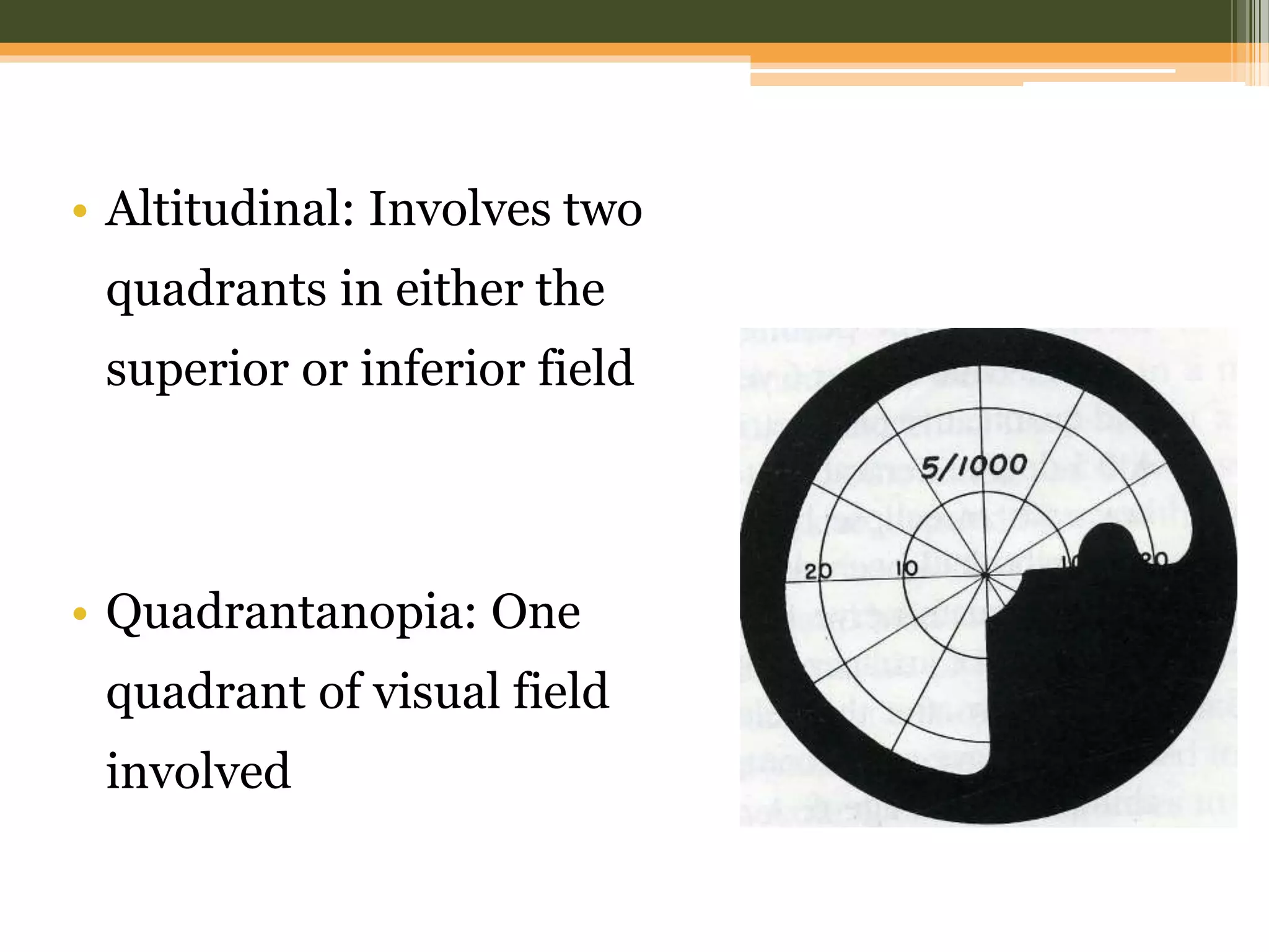 Central and peripheral visual field | PPTX