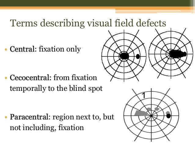 Central and peripheral visual field