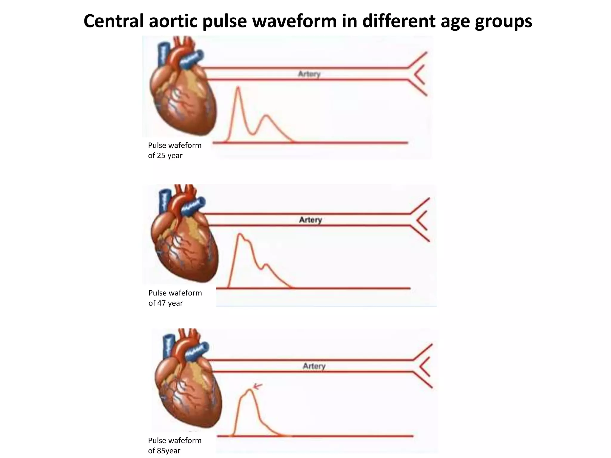 Central aortic pressure in management hypertension 2 | PPTX
