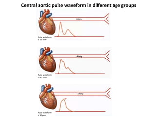 Central aortic pressure in management hypertension 2 | PPTX | Heart and ...