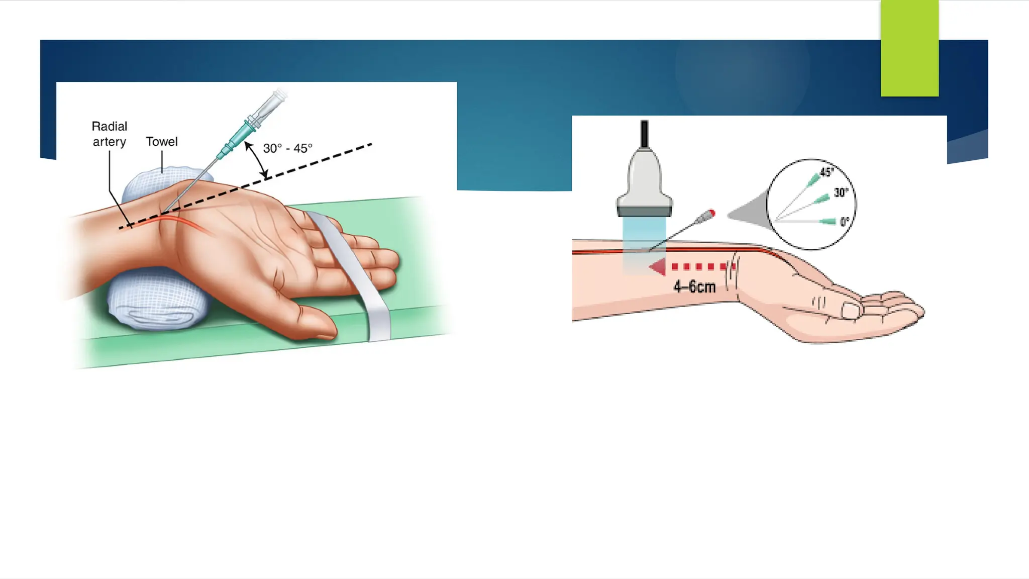 central and arterial line in medicine .pptx