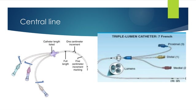 central and arterial line in medicine .pptx | First Aid | Injuries