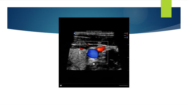 central and arterial line in medicine .pptx | First Aid | Injuries
