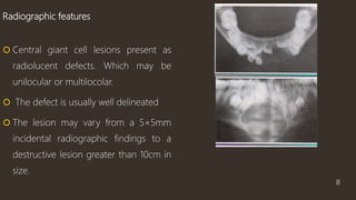 Central Giant Cell Granuloma Radiographic Features