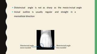 Maxillary Central Incisor | PPTX