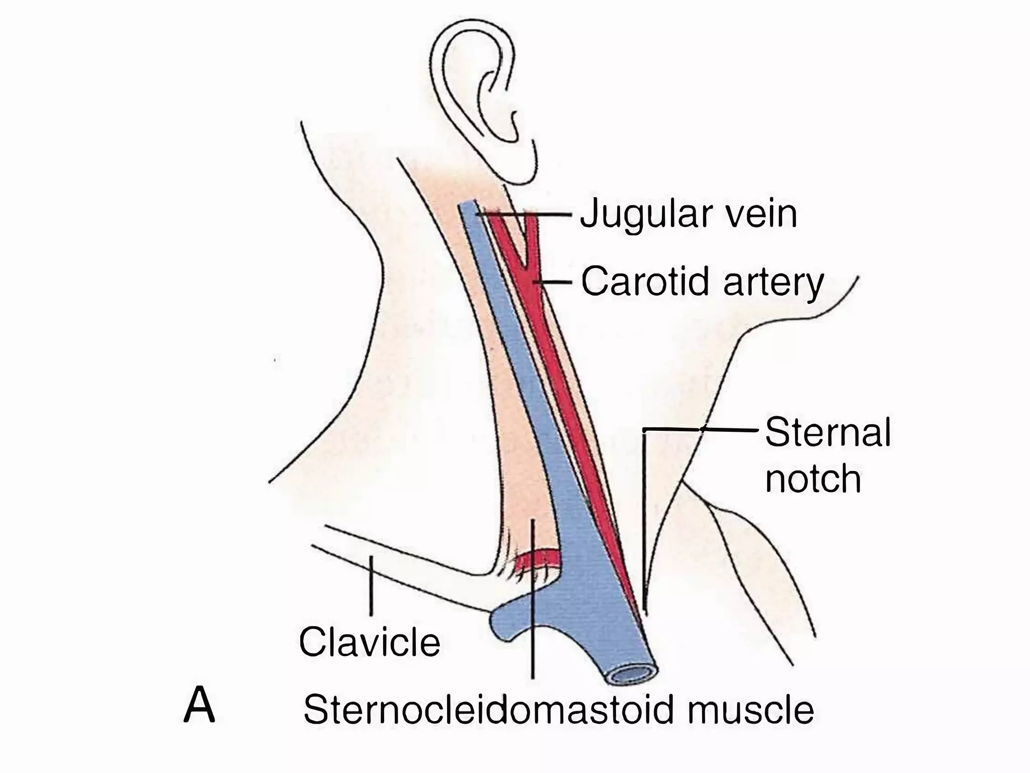 Central Line in Anesthesia | PDF