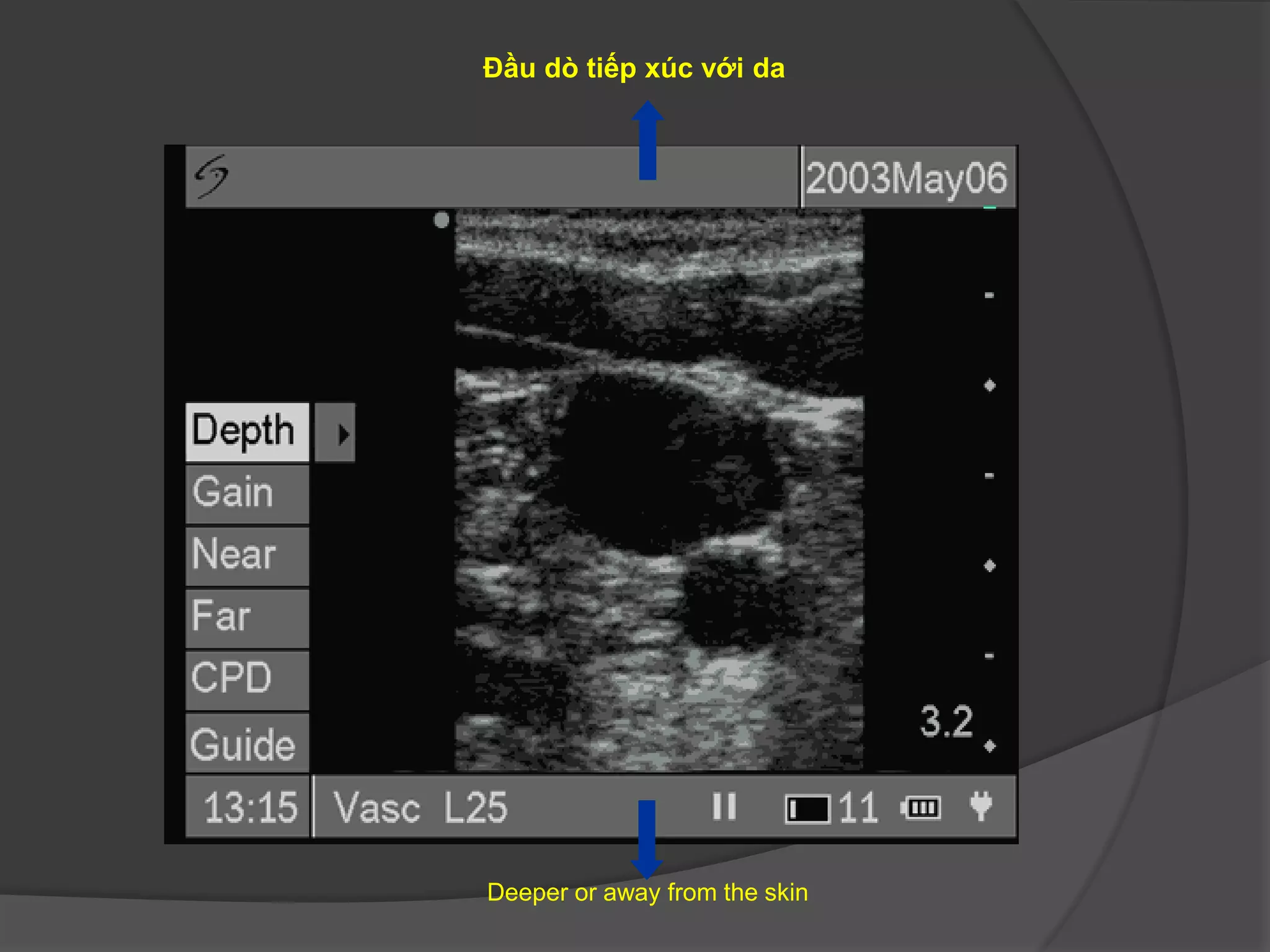 Central line insertion | PPT