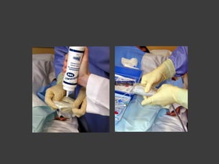 Central line insertion | PPT