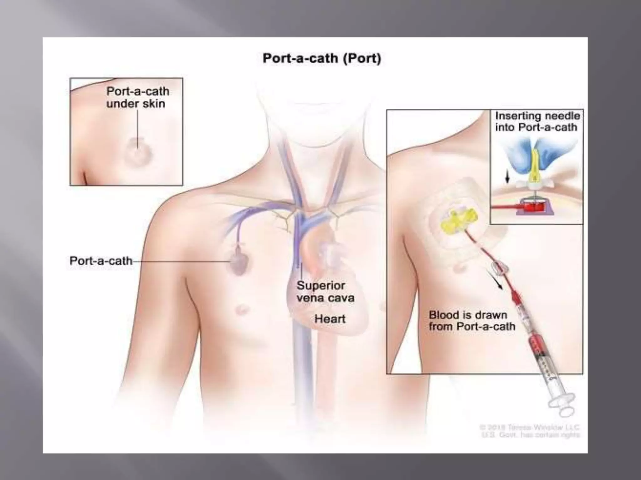 CENTRAL LINE INSERTION AND CARE.pptx