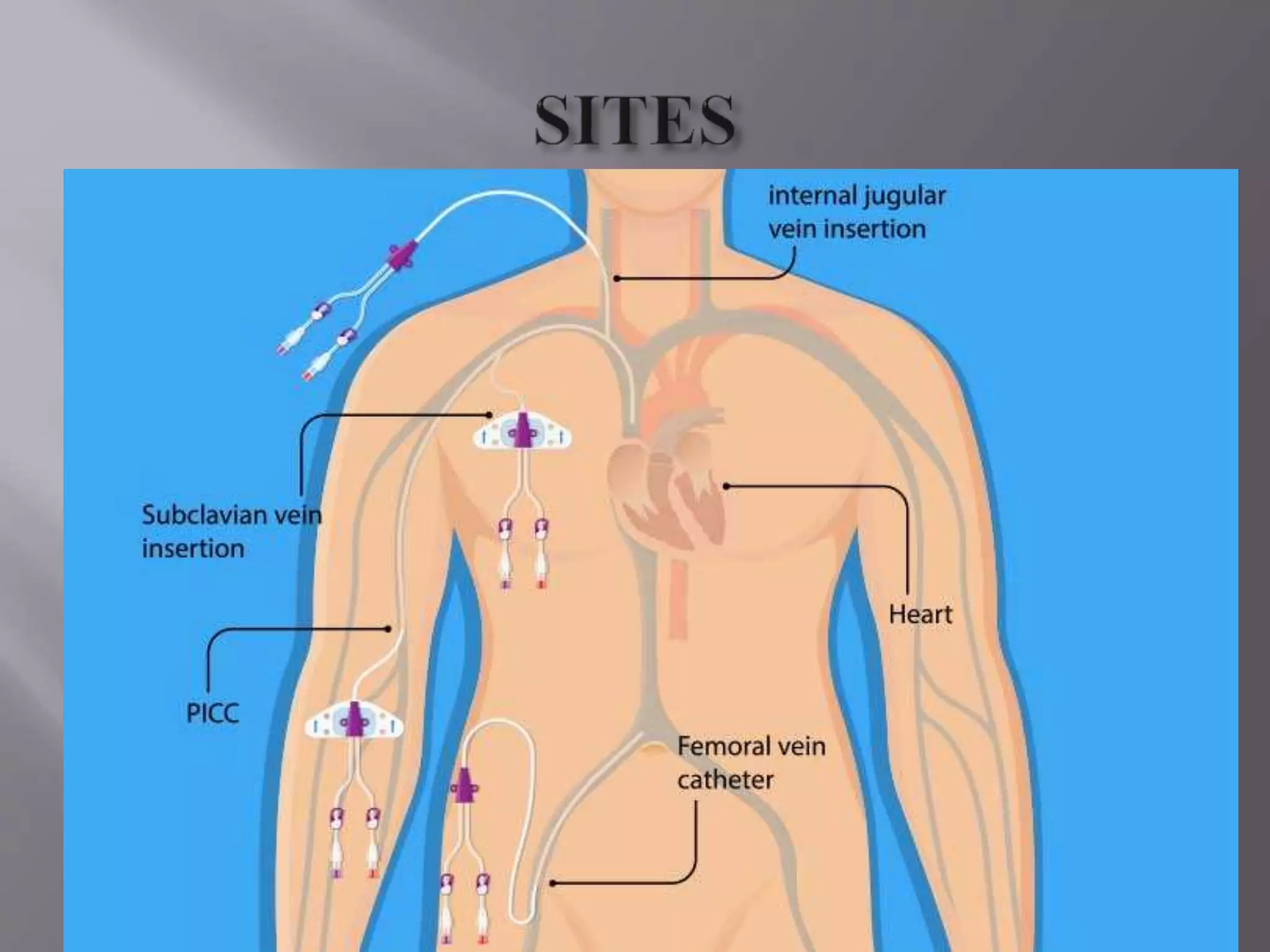CENTRAL LINE INSERTION AND CARE.pptx