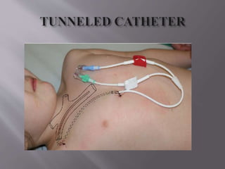 CENTRAL LINE INSERTION AND CARE.pptx