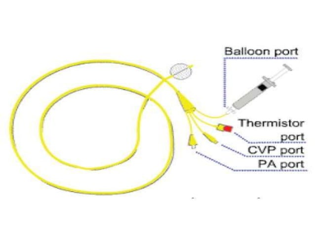 CENTRAL LINE INSERTION AND CARE.pptx | Heart and Cardiovascular ...