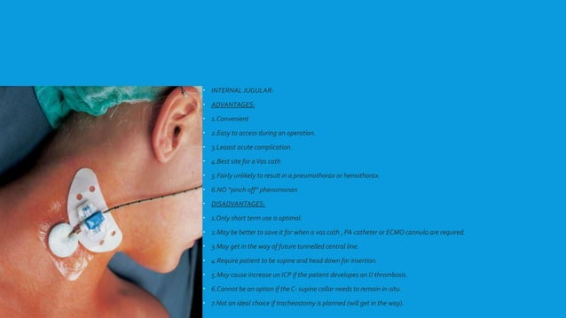 Central line placement | PPTX | First Aid | Injuries