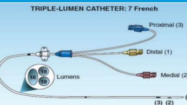 Central line placement | PPTX | First Aid | Injuries