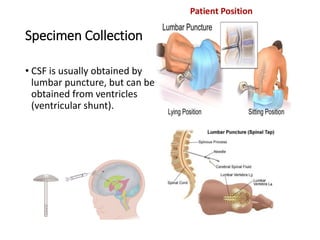 Clinical diagnostic Cytology Central Nervous System.pdf