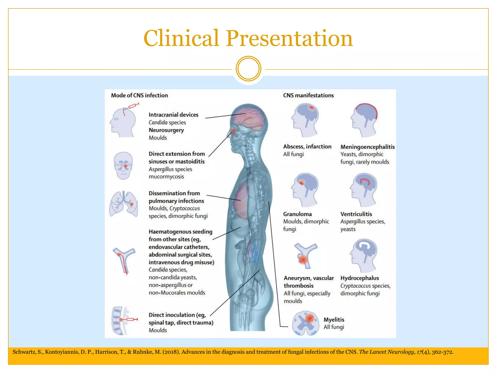 Central Nervous System Fungal Infections.pptx