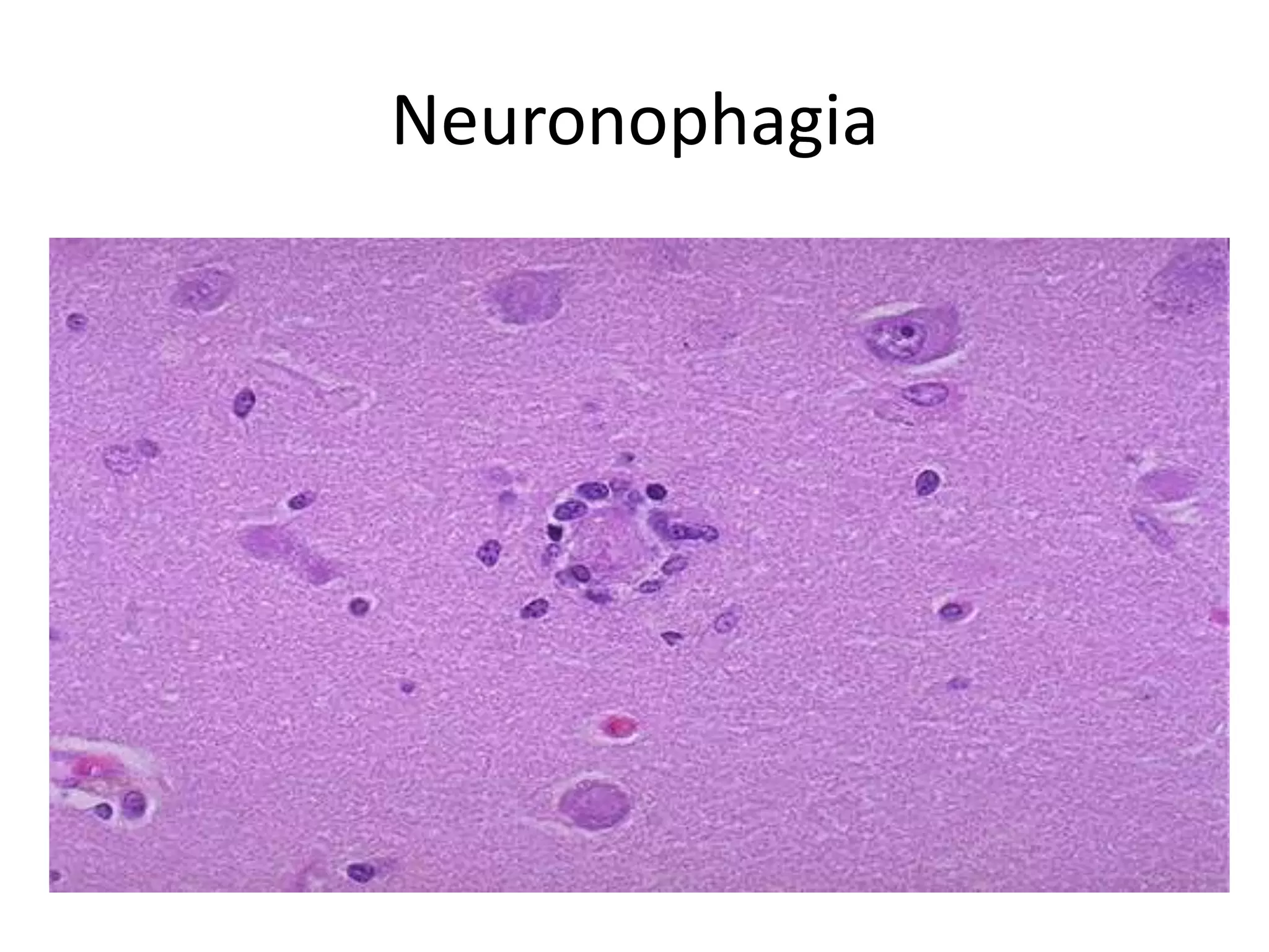 Central nervous system pathology lab | PPTX