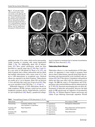 Central Nervous System Tuberculosis.pdf