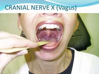 Central nervous system vidhya | PPTX