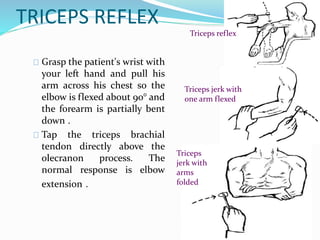 Tricep Reflex