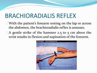 Brachioradialis Reflex
