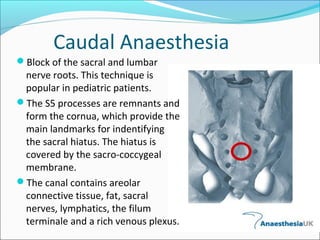 Caudal Anesthesia Technique