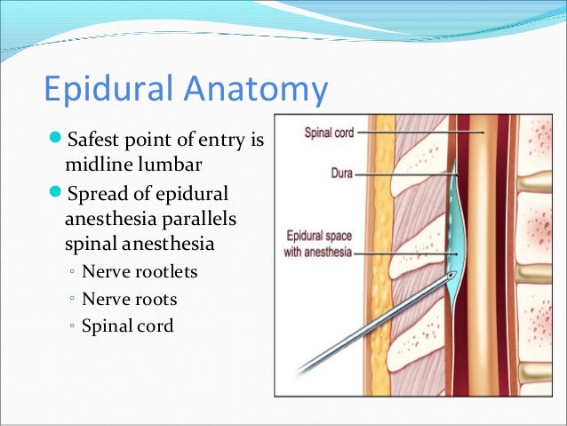 Epidural Blood Patch PPT MYELOGRAPHY And CNS Exams Using MRI & CT